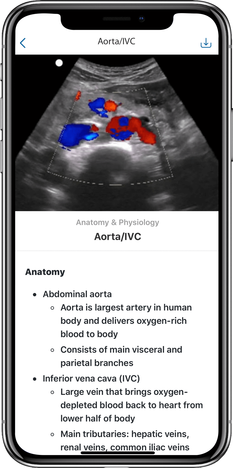 Onboarding – SonoSim